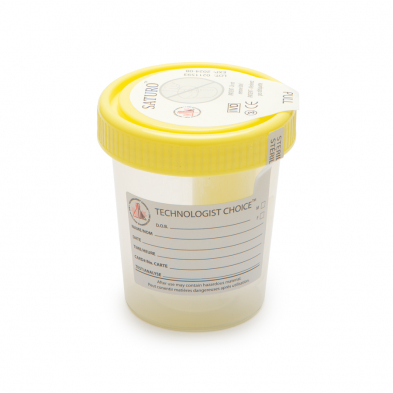 Mf Lab - Urine Container Yellow - medicaltradehub.com