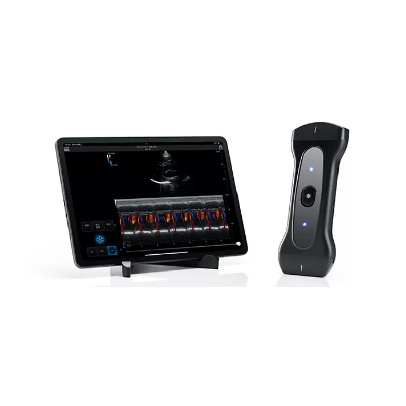 Handheld Ultrasound Device PIU2A | Medical Trade Hub UAE